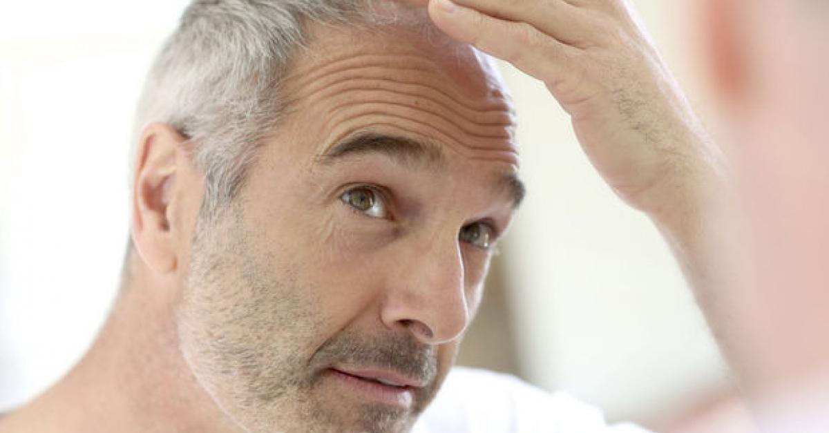 Les avantages d'être chauve