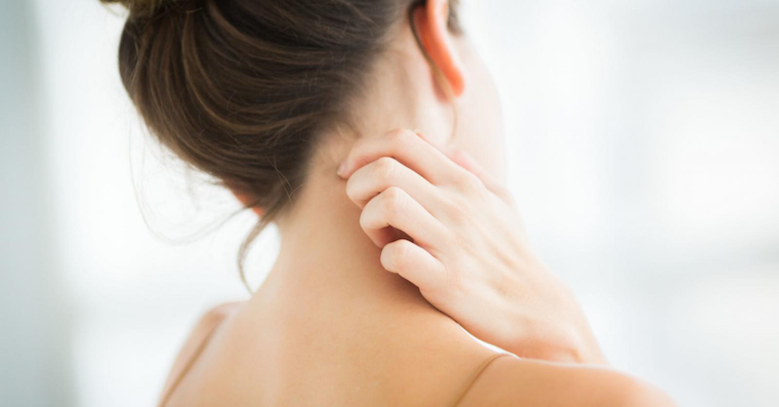 Netelroos: dit moet je erover weten! - Libelle