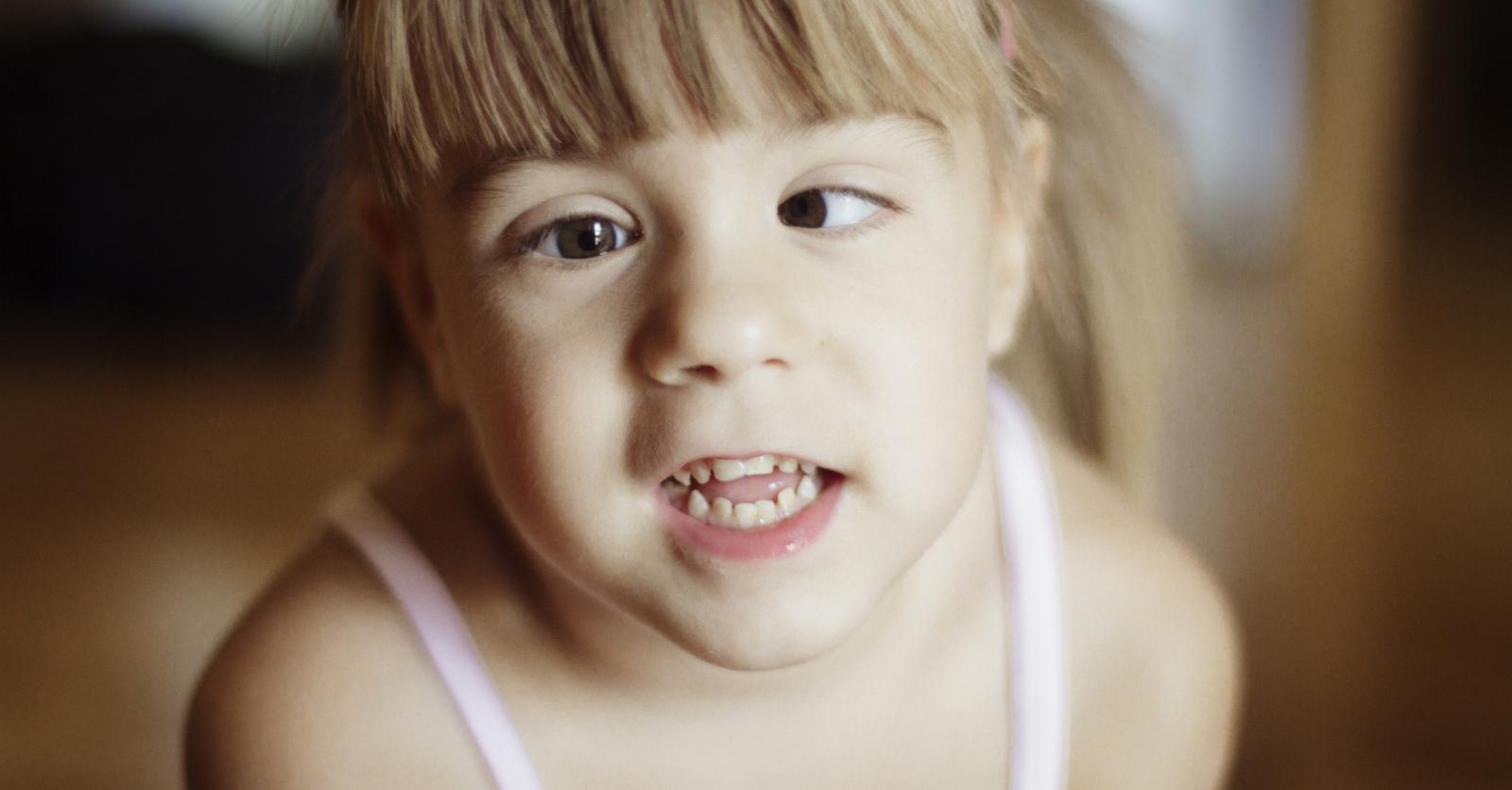 Scheelzien: wat is het en wat doe je eraan? - Libelle Mama