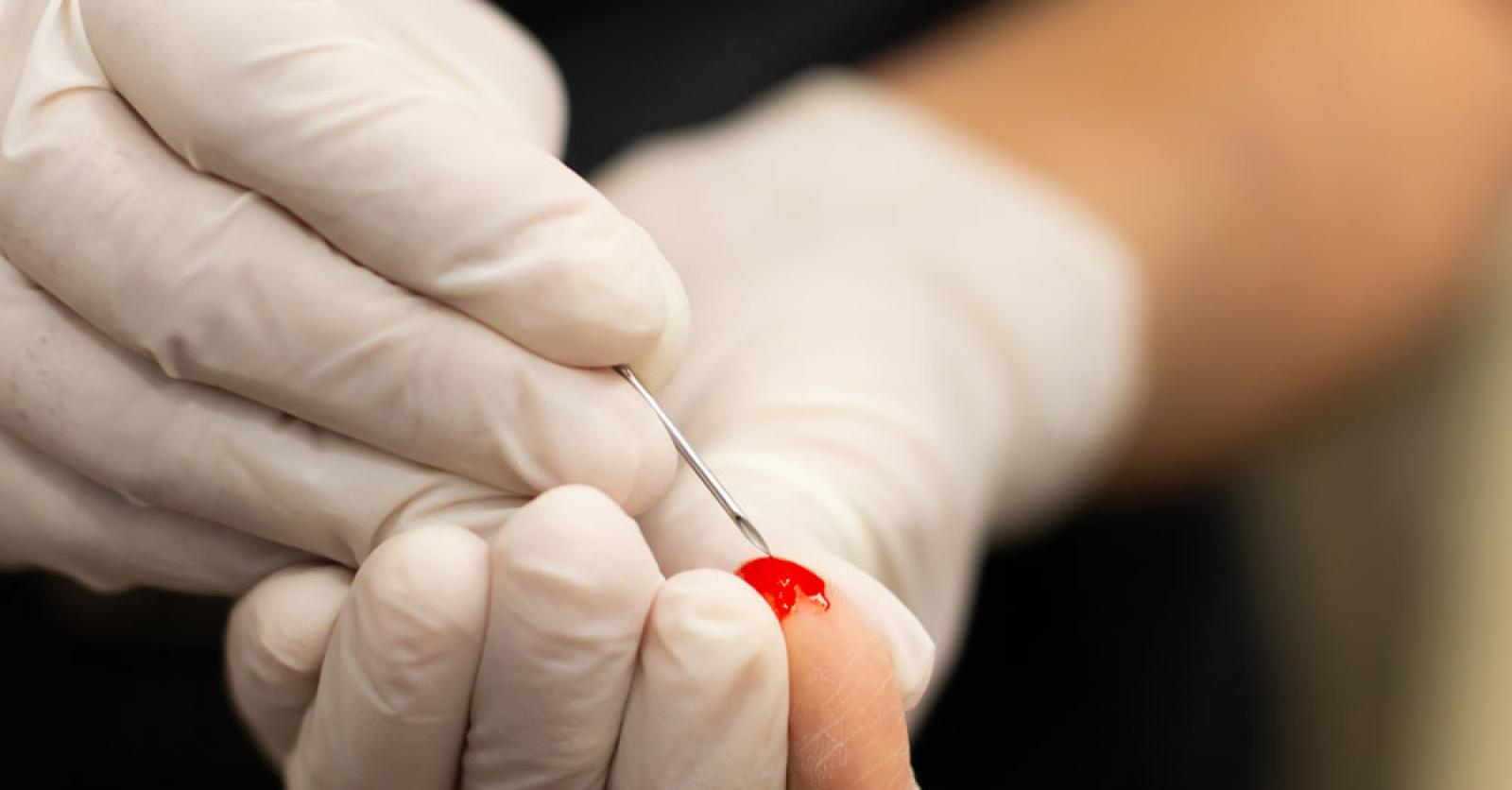 Mysterie van de dag: waarom is bloed rood?