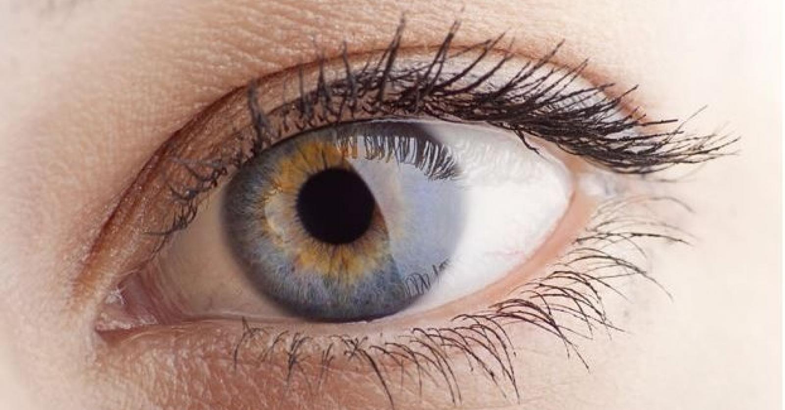 Troubles de la vision: 10 symptômes courants et ce qu'ils signifient ...