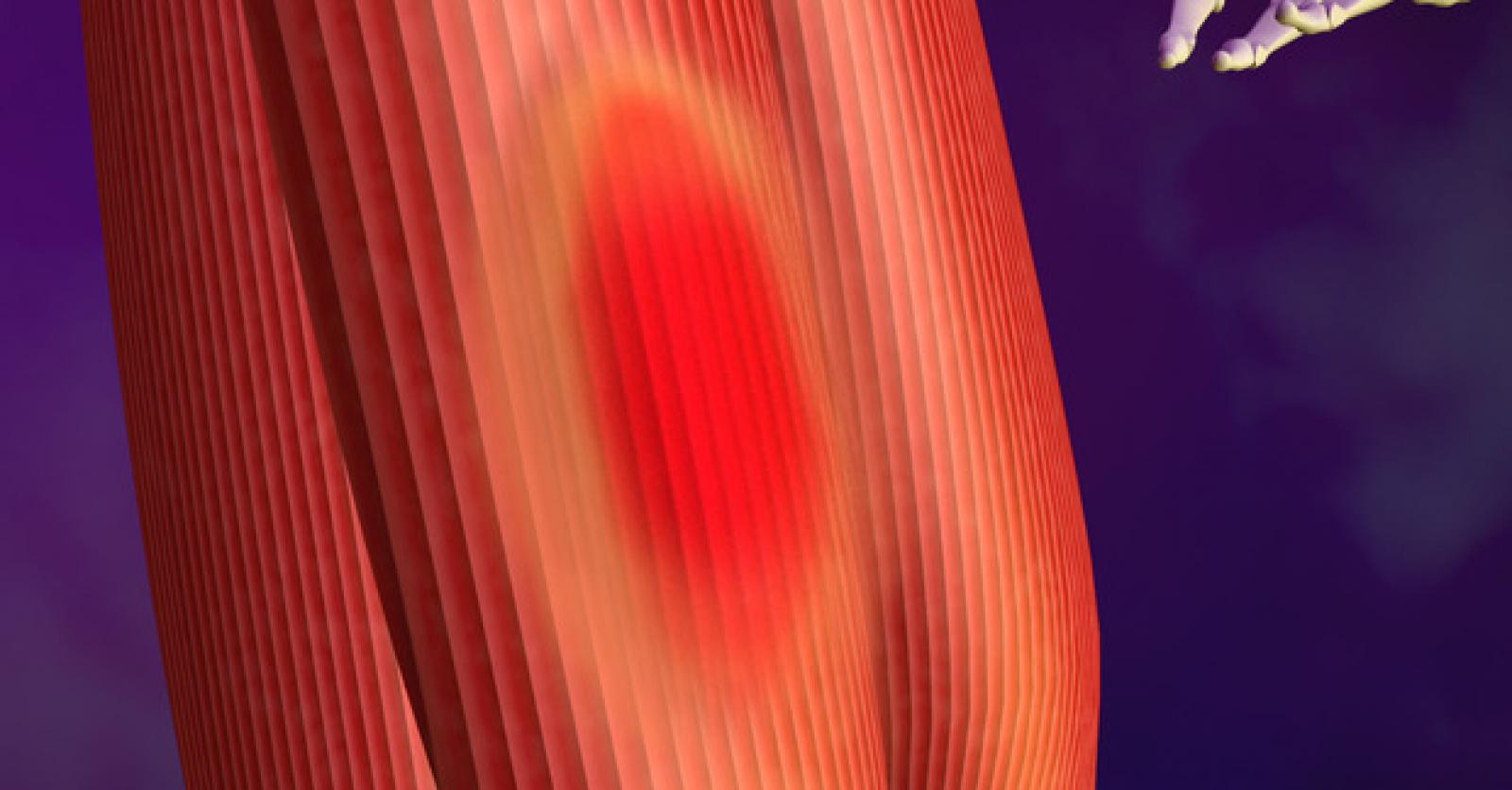 Élongation du muscle ischio-jambier - Plus Magazine