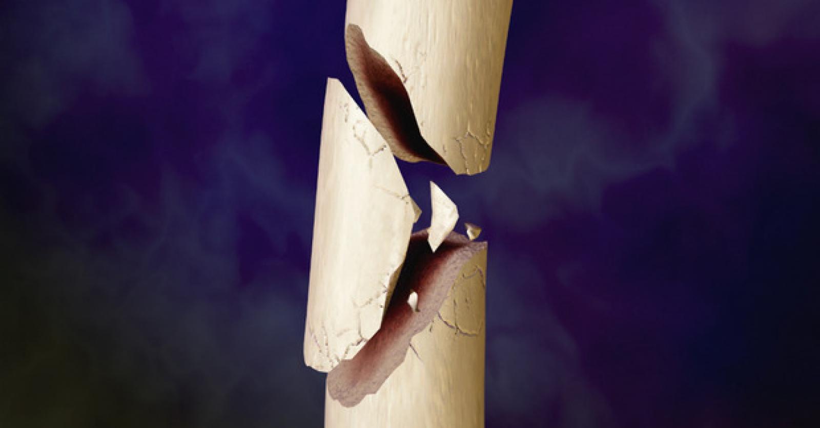 Botbreuken (1) - Plus Magazine