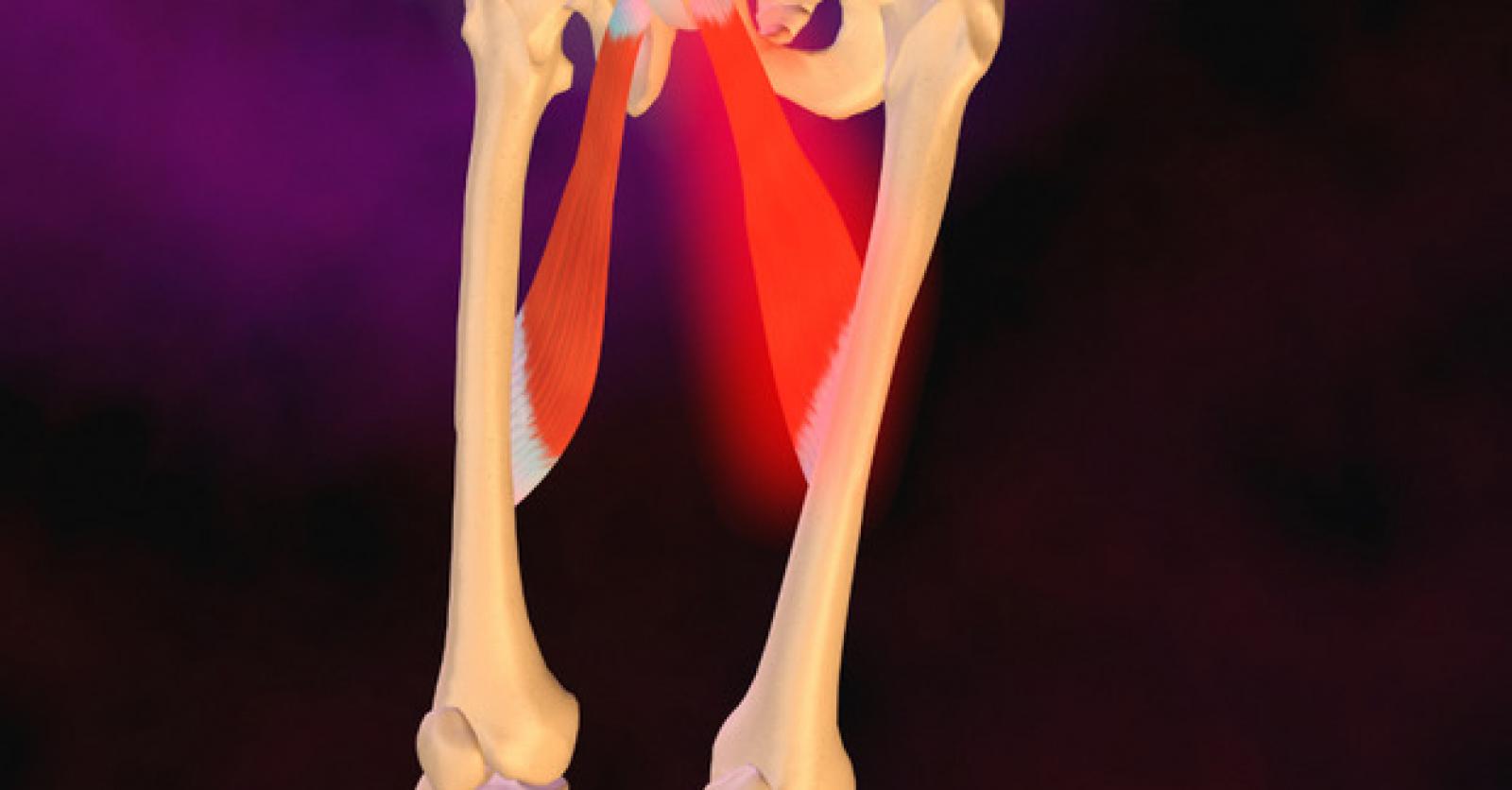 Verrekte liesspier - Plus Magazine