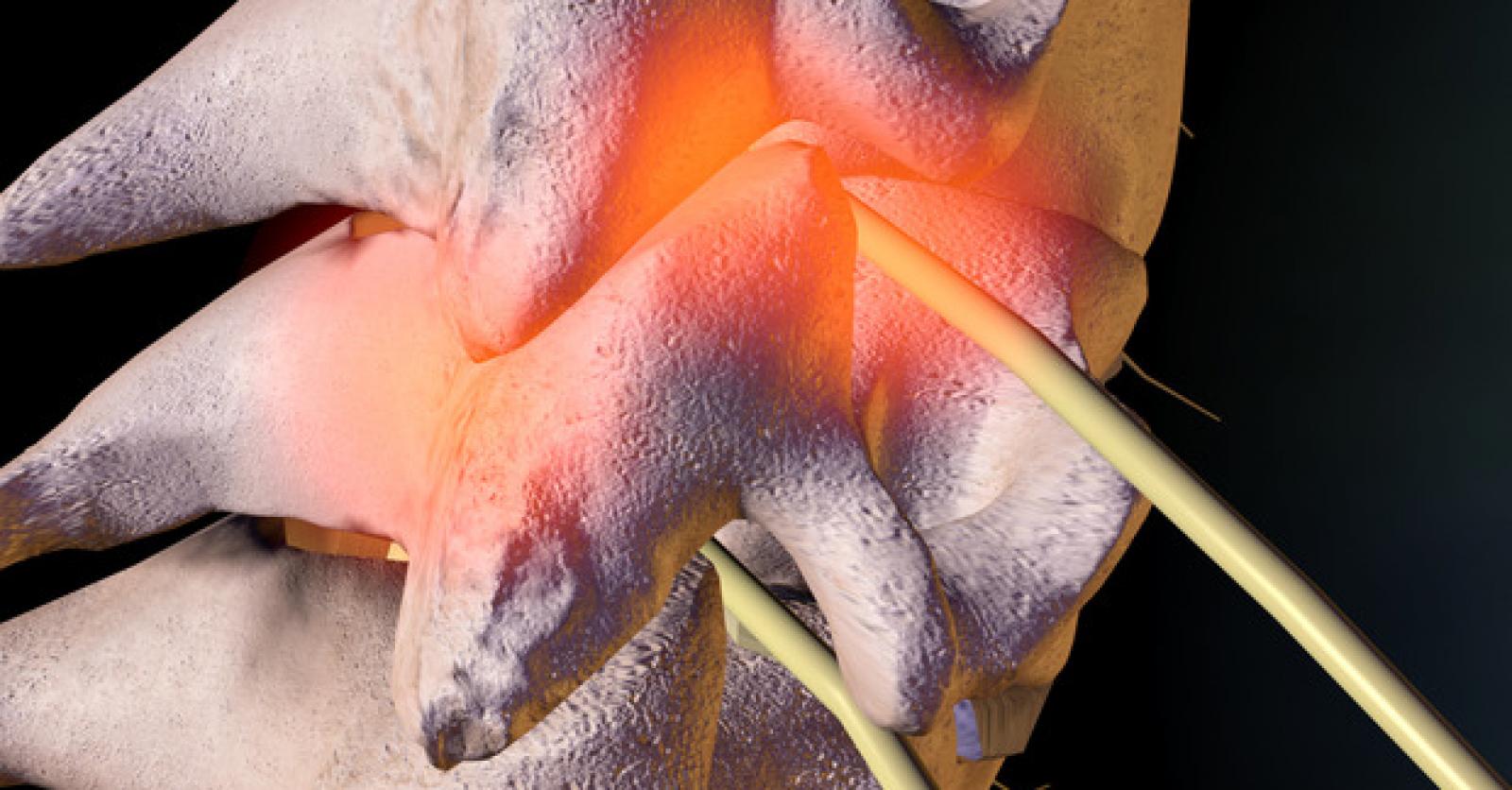 Facetgewrichten - Plus Magazine