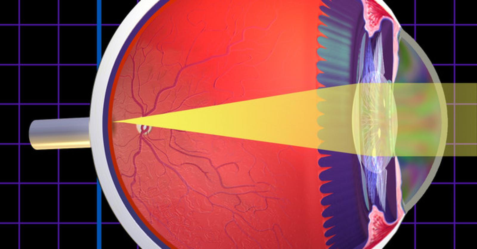 Bijziendheid en verziendheid - Plus Magazine