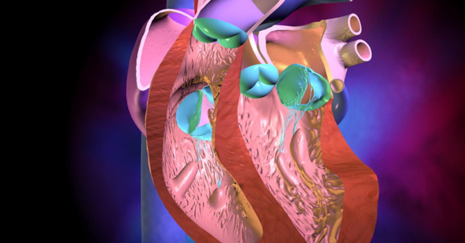 Insuffisance valvulaire - Plus Magazine