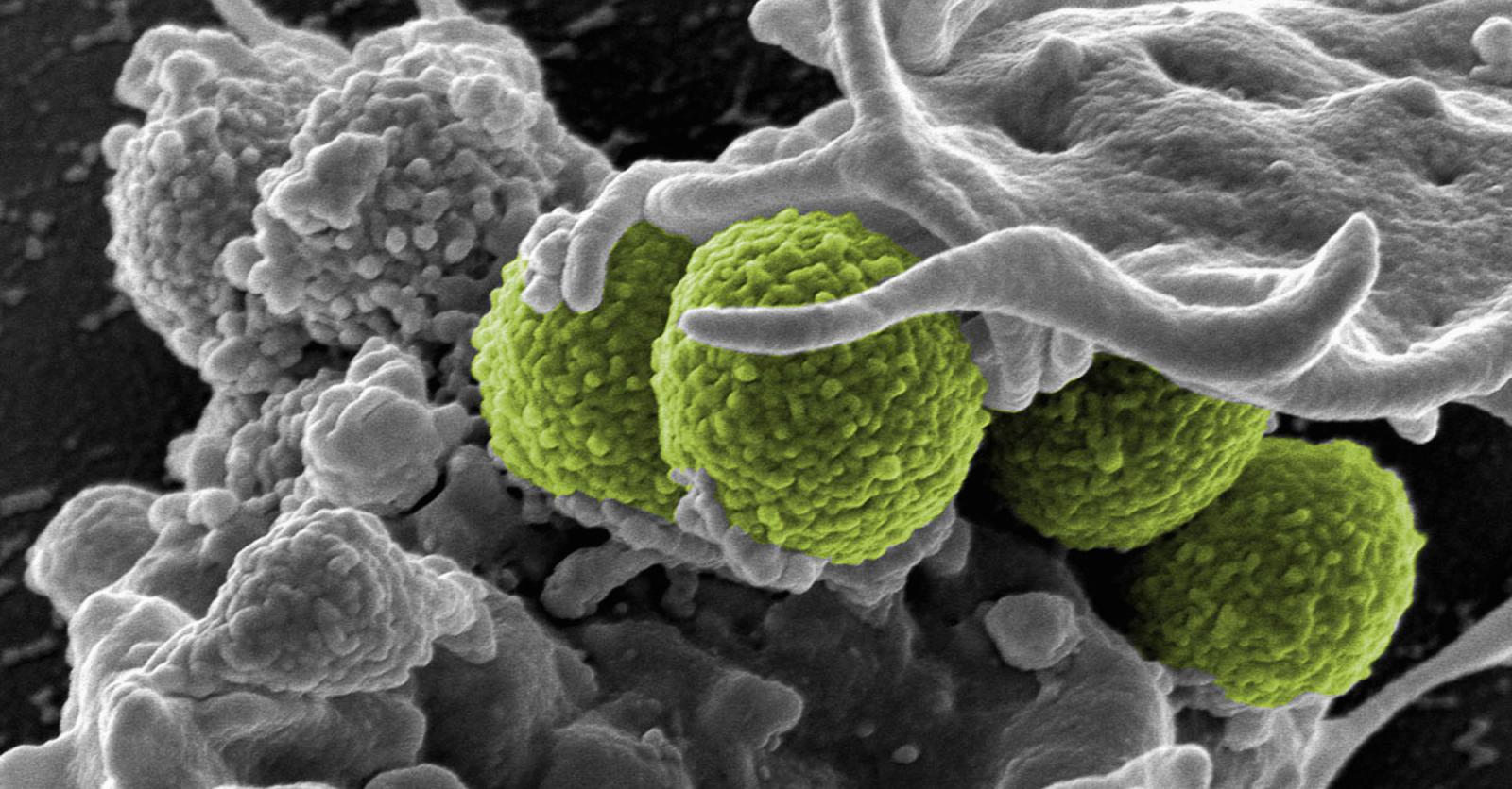 Le staphylocoque doré hiberne lors d'un traitement antibiotique - Plus ...