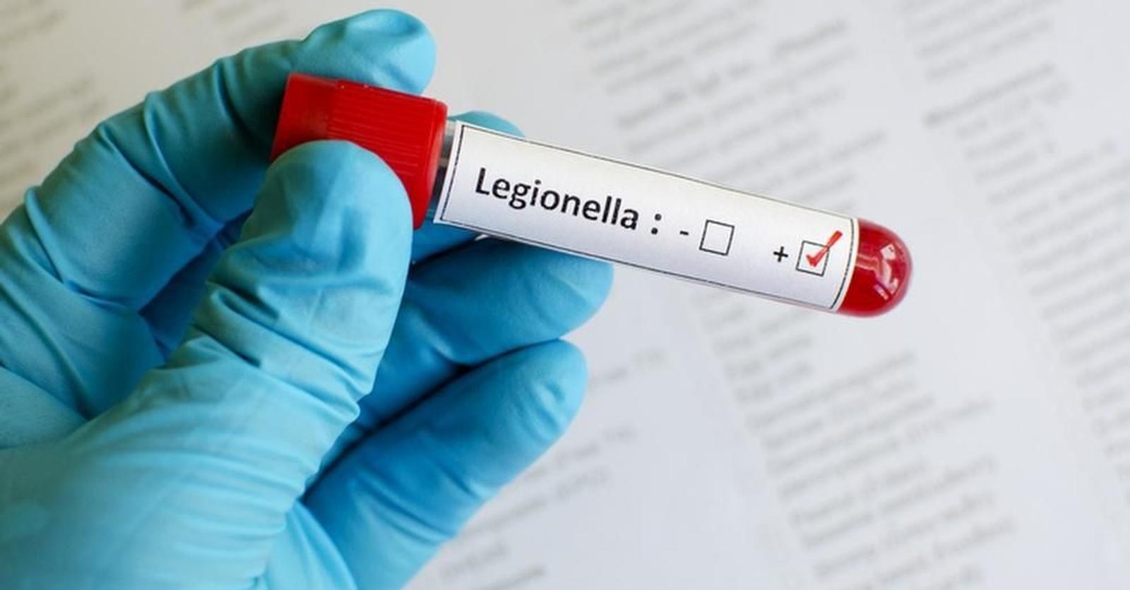 Uitbraak van legionellose: hoe raak je besmet door Legionella? - Plus ...