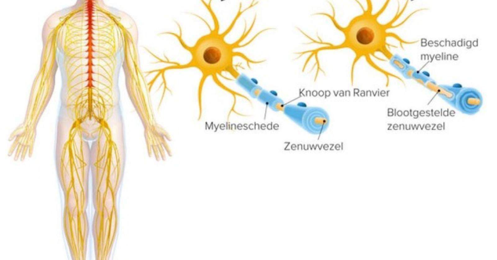 Zenuwvezels in hun blootje - Plus Magazine