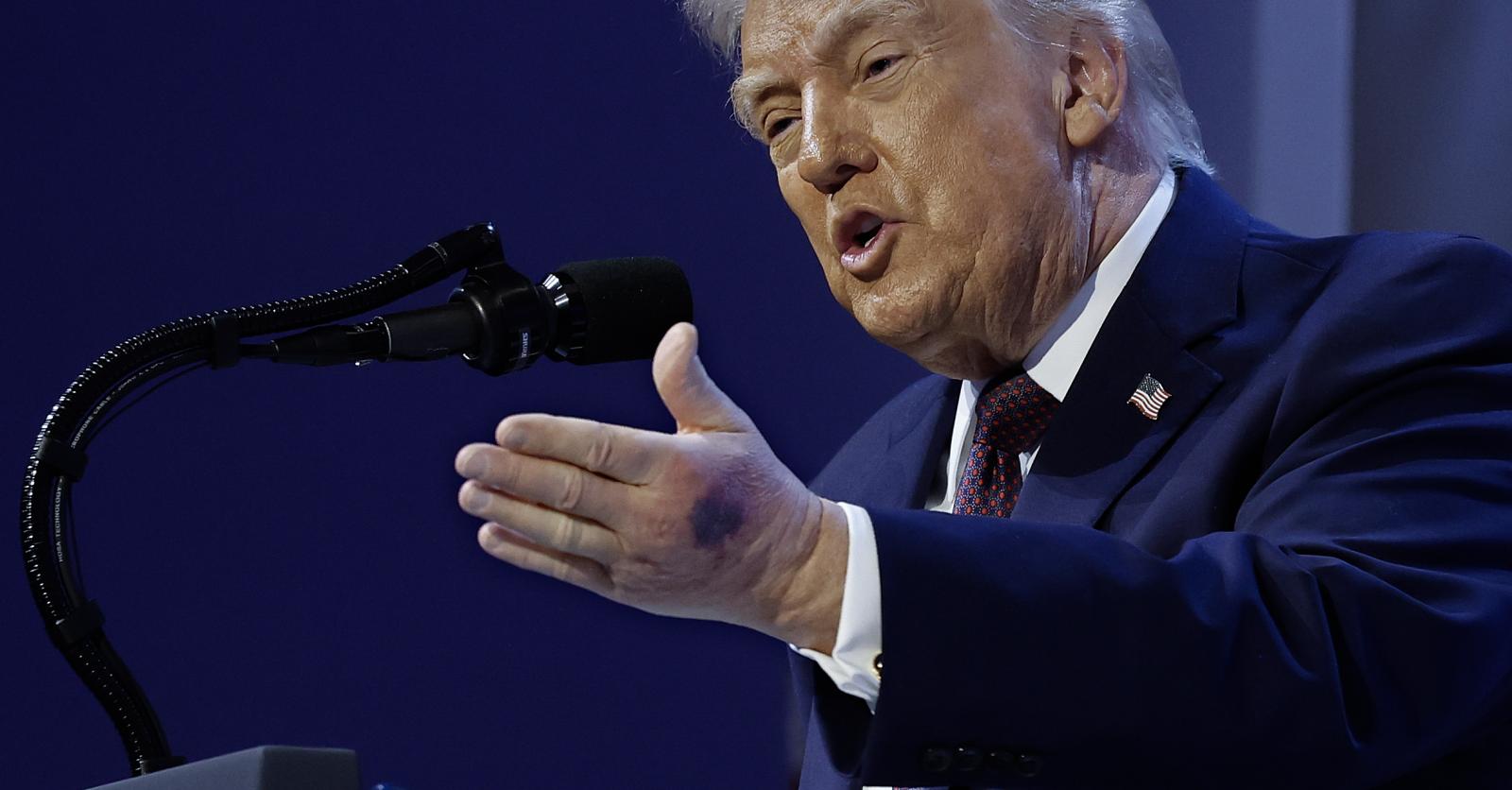 Donald Trump «est toujours en excellente santé», mais doit continuer à ...