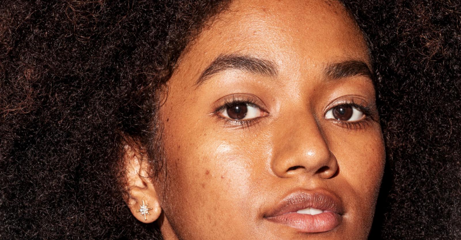 Lutter contre les taches pigmentaires, la nouvelle obsession beauté?