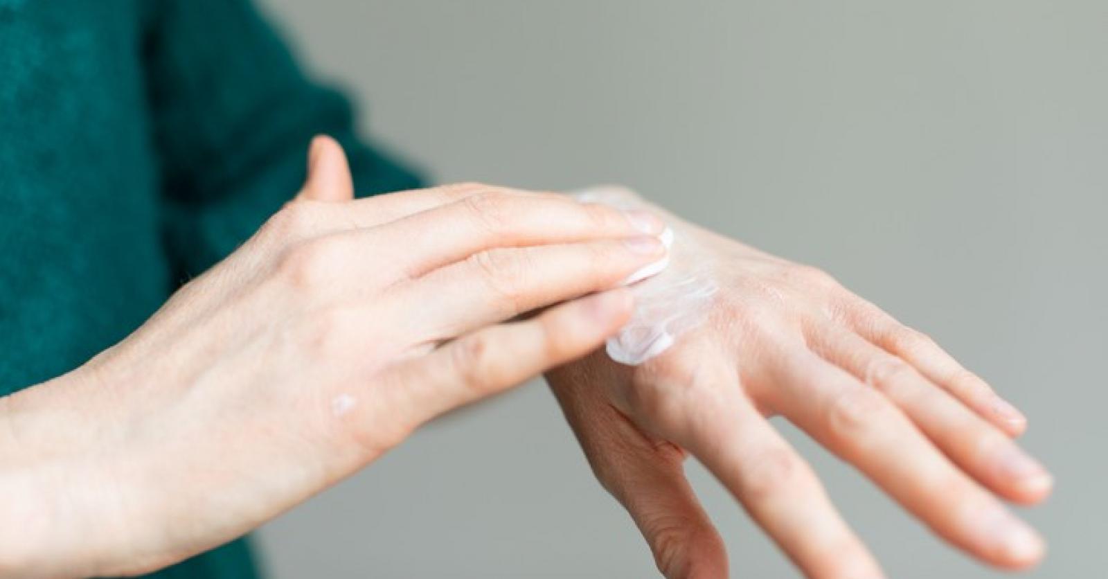 Kloven op de handen: zo kun je ze voorkomen en behandelen - Libelle