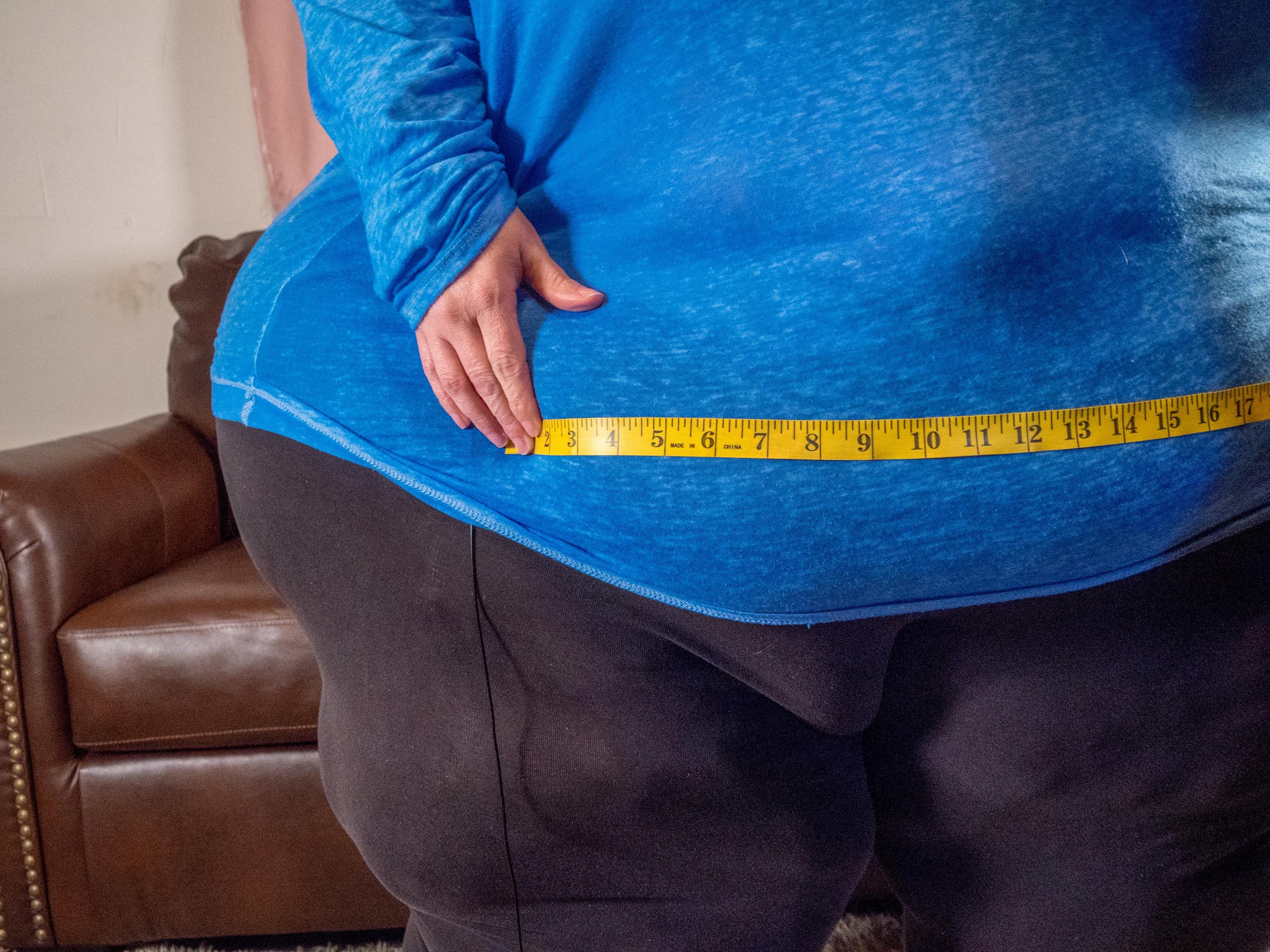 En Europe, près d'un quart des adultes sont obèses: l'OMS s'alarme