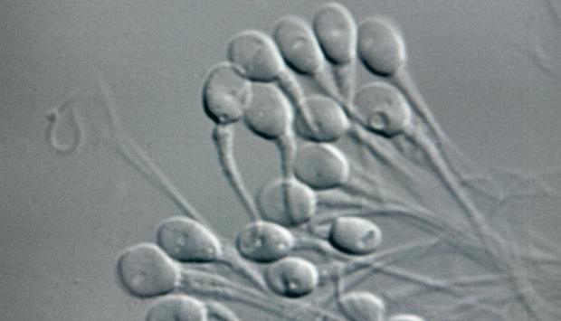 Zaadcellen vormen turbospan