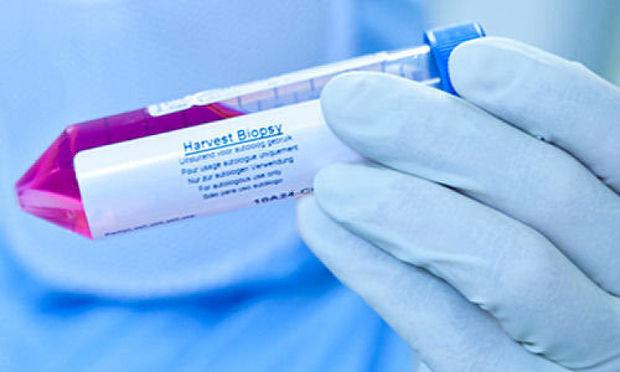 Nouvelle avancée pour TiGenix - Trends-Tendances