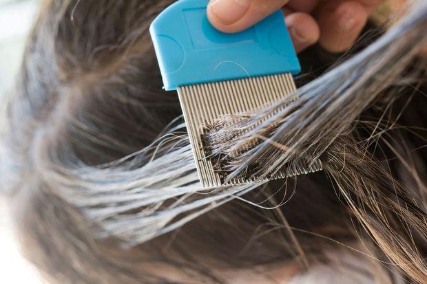 Zo werk je hoofdluizen doeltreffend weg