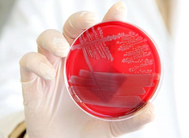 Bactérie E-coli : Sabine Laruelle se veut rassurante Bactérie E-coli : Sabine Laruelle se veut rassurante