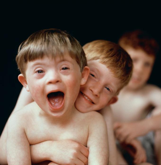 Leven met een handicap