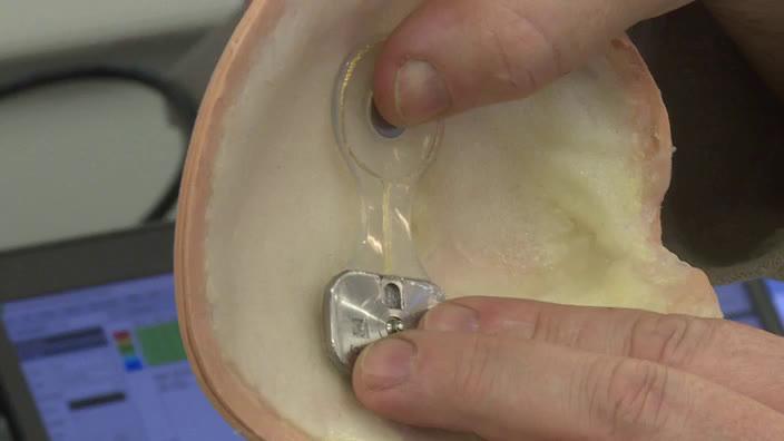 Cochlear Mechelen: wereldleider gehoortoestellen. - Trends Kanaal Z